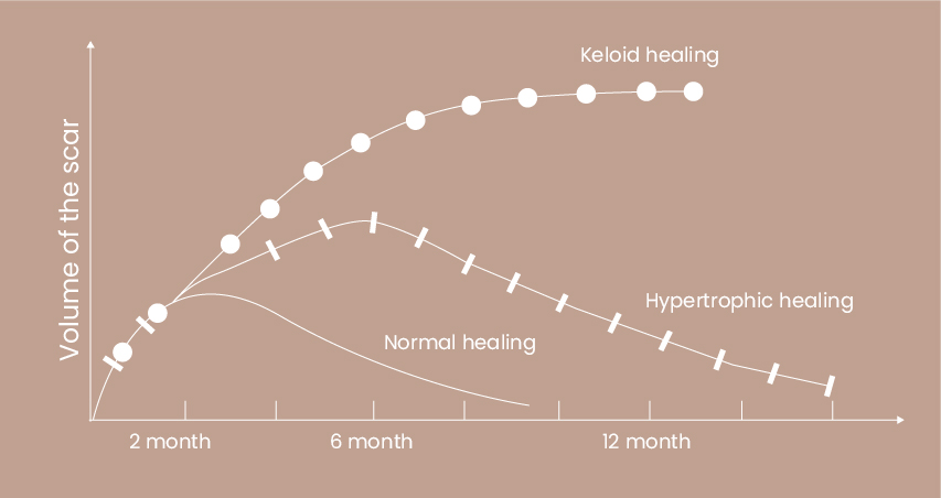 4 months post op not being constant with scar care. help?? : r/TopSurgery